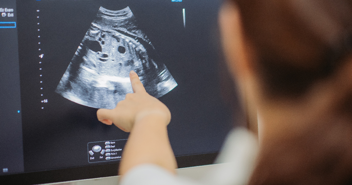 5 Conditions That Can Affect a Pregnancy | Rush