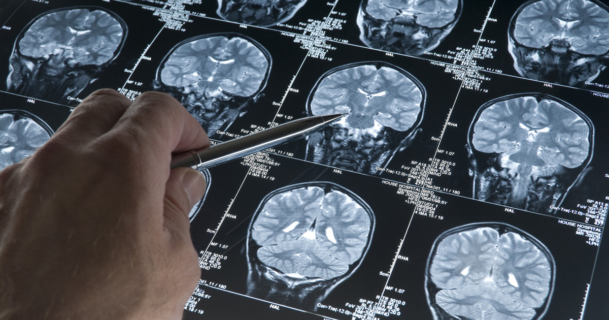 Surviving A Stroke Rush